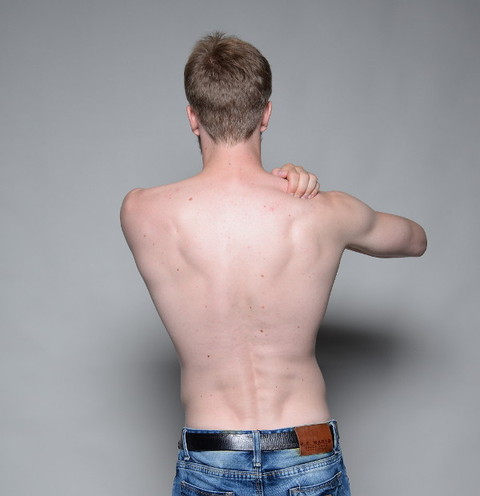 Unterarmschmerzen – außen und innen – einfach selbst lösen