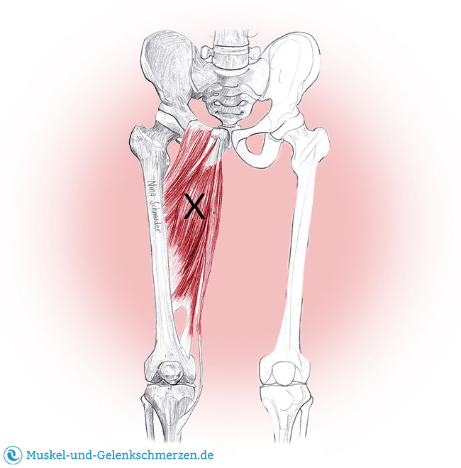 Adduktoren Schmerzen und Triggerpunkte selbst behandeln