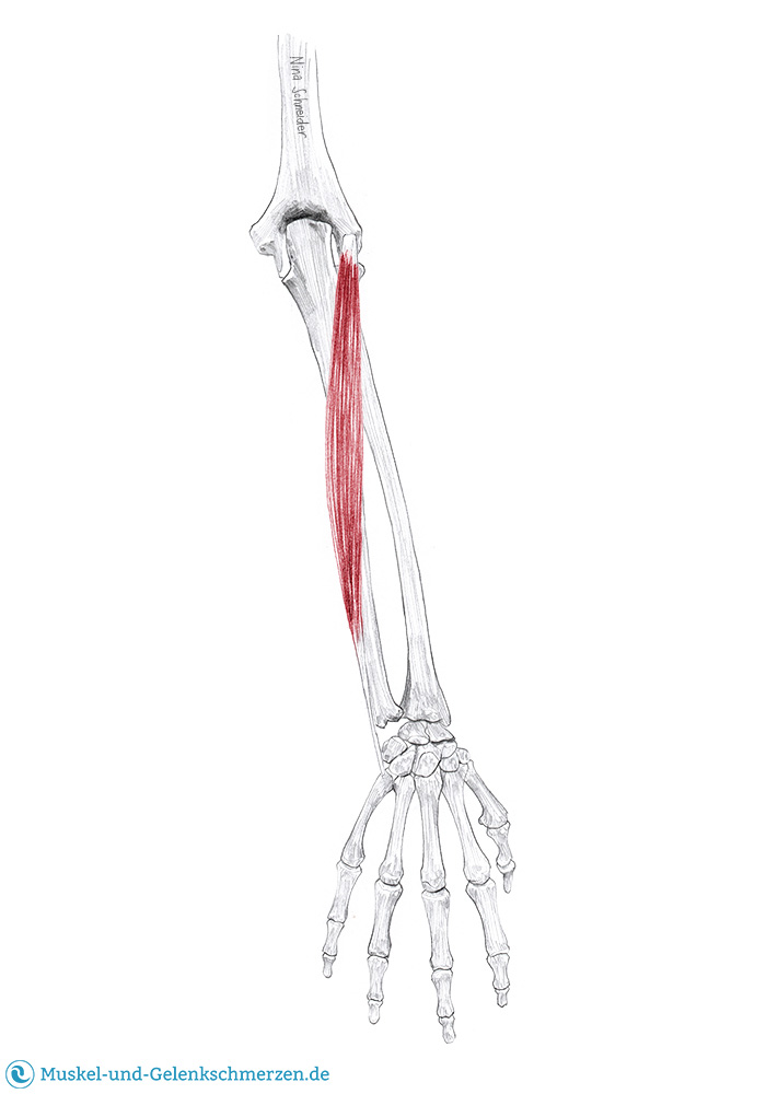 Extensor carpi ulnaris Schmerzen und Triggerpunkte selbst behandeln