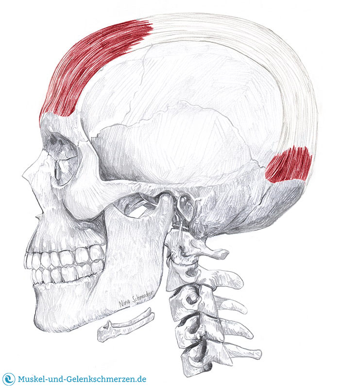Frontalis und Occipitalis Schmerzen und Triggerpunkte selbst behandeln
