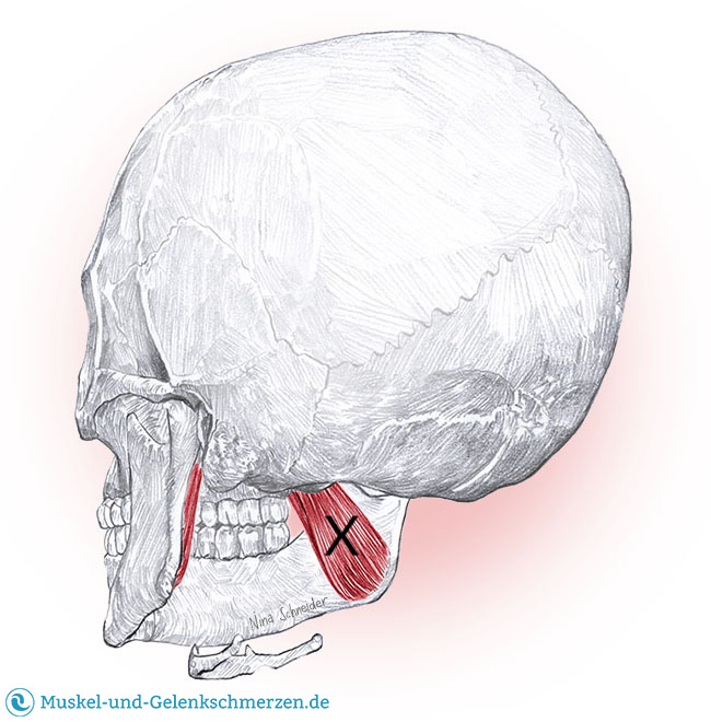Pterygoideus Medialis