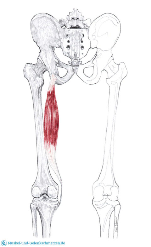 Ischiocrurale Muskulatur: Schmerzen und Triggerpunkte selbst behandeln