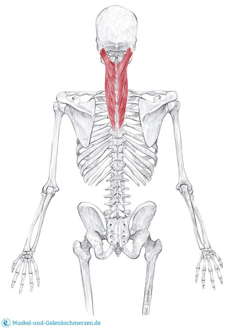 Splenius capitis und cervicis Schmerzen und Triggerpunkte selbst behandeln