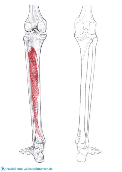 Posterior Tibialis Trigger Point Foot And Ankle Pain From Posterior