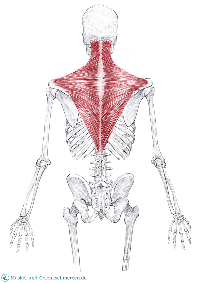 Trapezius Schmerzen und Triggerpunkte selbst behandeln