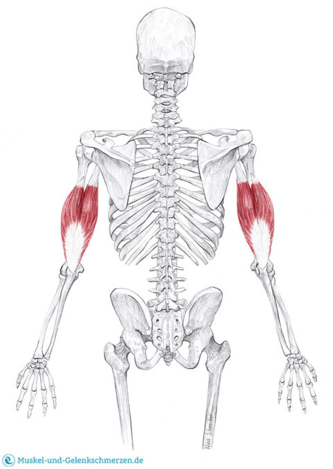 Trizeps Schmerzen und Triggerpunkte selbst behandeln